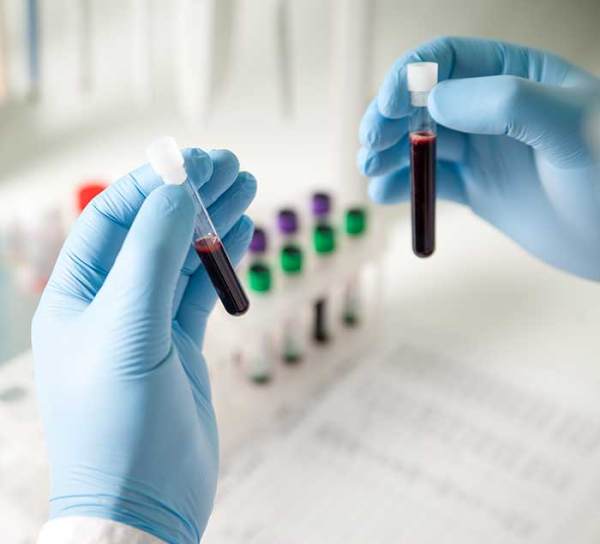 Lab Tests at enTrust Urgent Care Center Clinic & Walk-in Clinic